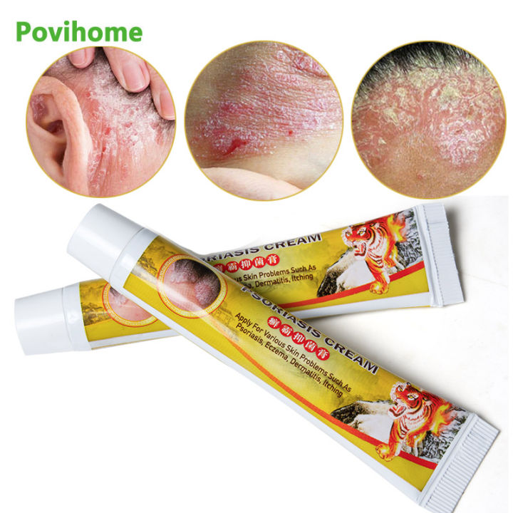 [cod]sumifun Psoriasis Eczema Treatment Cream Herbal Antibacterial