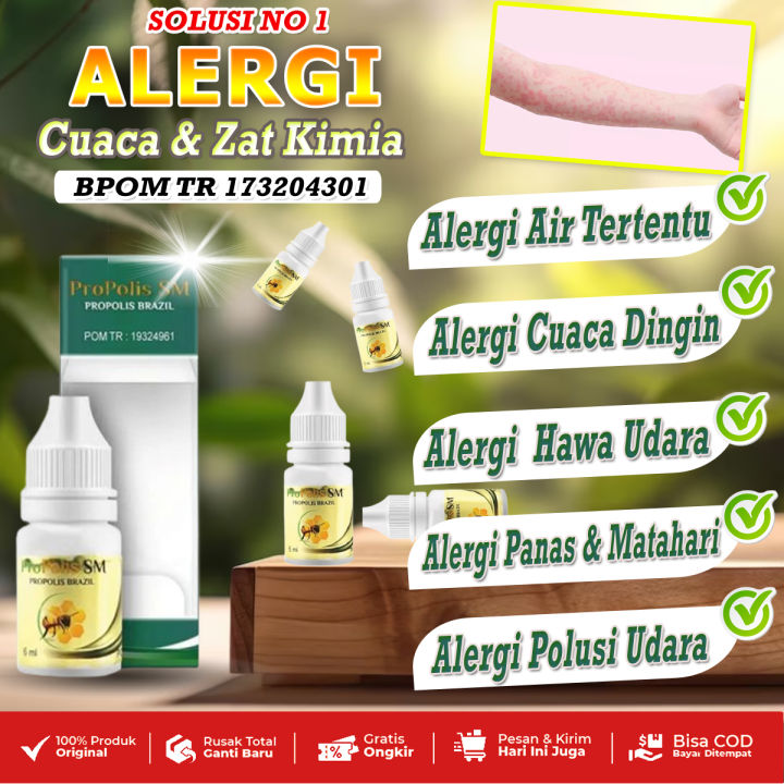 Obat Untuk Alergi air mandi Cuaca hawa udara Angin panas matahari suhu ...
