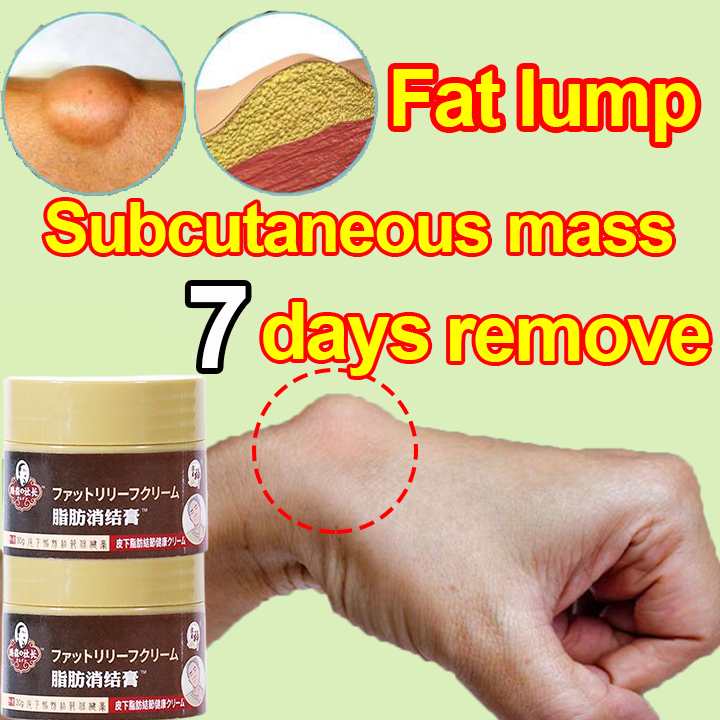 Japanese Lipoma Removal Cream original japan 30g Treat Tumor Skin ...