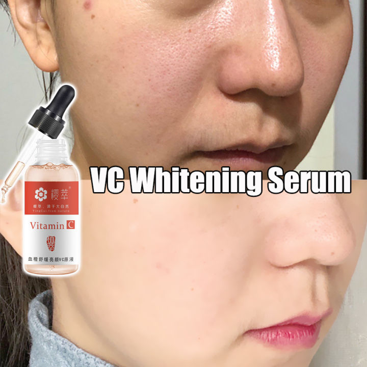 Blood Orange Extract Soothing Whitening VC Facial Serum Lighten Pigment ...