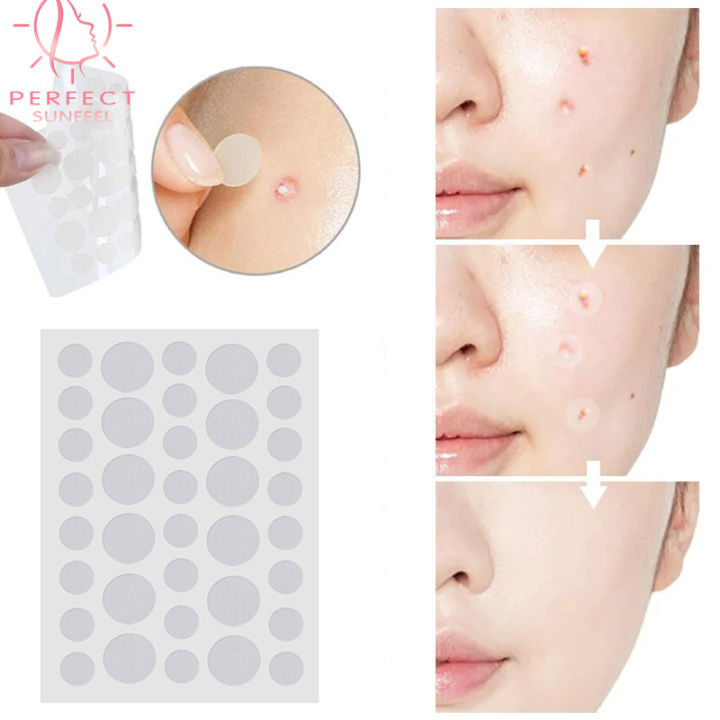 สิวเสี้ยนสติกเกอร์กันน้ำกำจัดสิวจางลงสิวสิว Blemish Spot Facial Mask ...