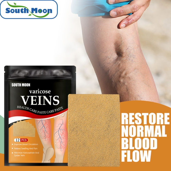 【Hot Sale】South Moon Varicose Veins Remover Effective Original Varicose ...