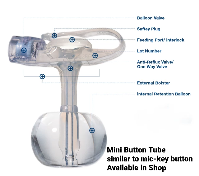 Mini Button Tube, KIT, Gastrostomy Feeding Tube, Mic-key Button tube ...
