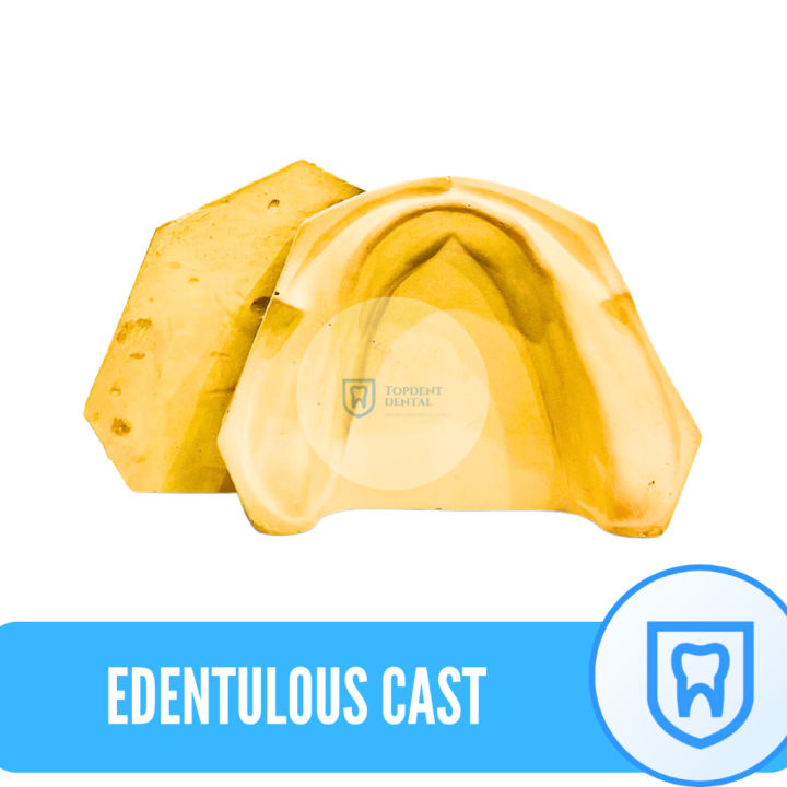 Edentulous Model Cast Teeth Model Study Cast for Dental Students (Upper ...