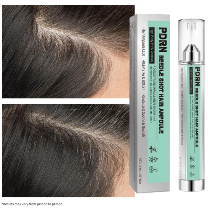 PDRN Intensive Hair Care Ampoule 15ml Hair Loss Care Scalp Treatment ...