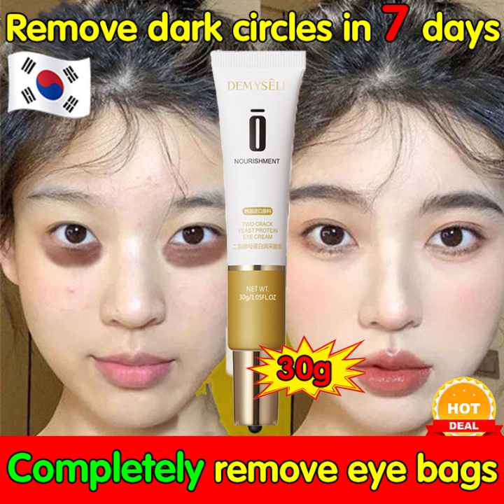 DEMYSELF Eye Cream 30g Remove Eye bags Anti Puffiness Gel Dark Circles ...