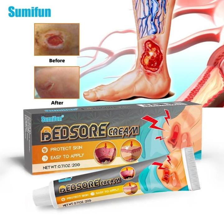 100% Effective 20g Bed Sore Cream Bedsore Ointment Bed Sores Treatment ...