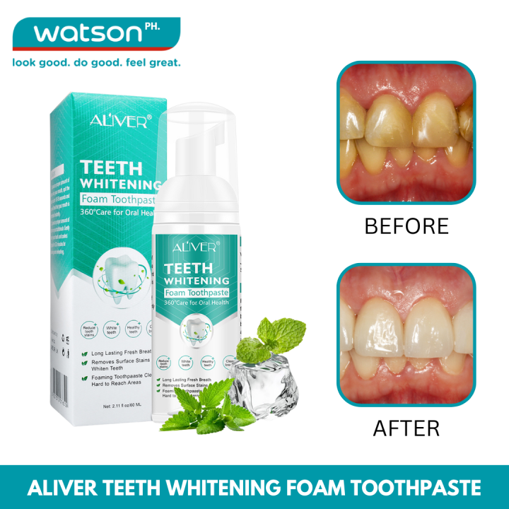 Watson ALIVER Teeth Whitening Foam Get a Brighter Smile with Aliver ...