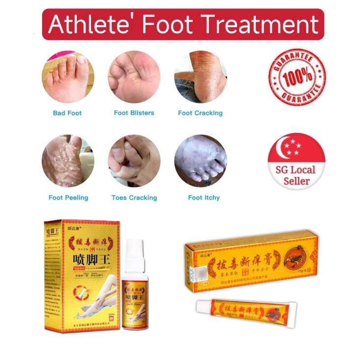 Athlete's foot ointment cream/ spray for Itchy and rotten feet ...