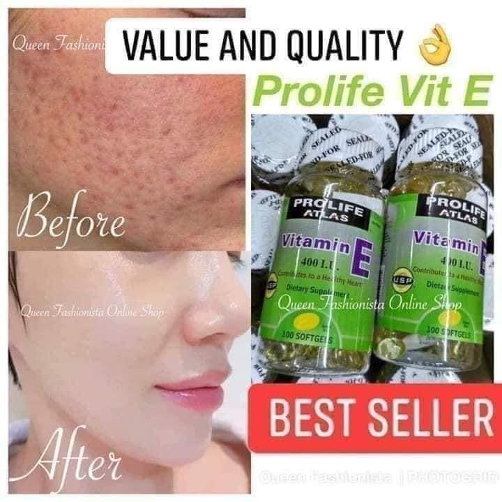 Prolife Atlas Vitamin E 100 Softgels | Lazada Singapore