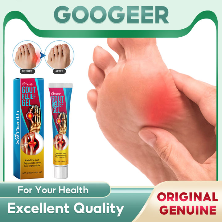 Ximonth Gout Relief Gel Foot Correction To Relieve Swelling Tendon ...