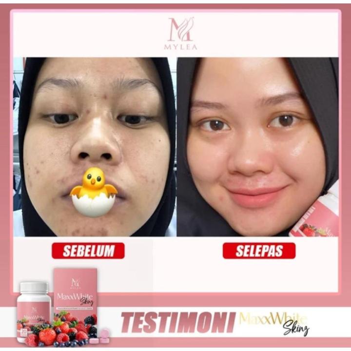 Rm0 ShippingMylea Maxxwhite Skinz VITAMIN PUTIH UBAT PUTIH SUPPLEMENT ...