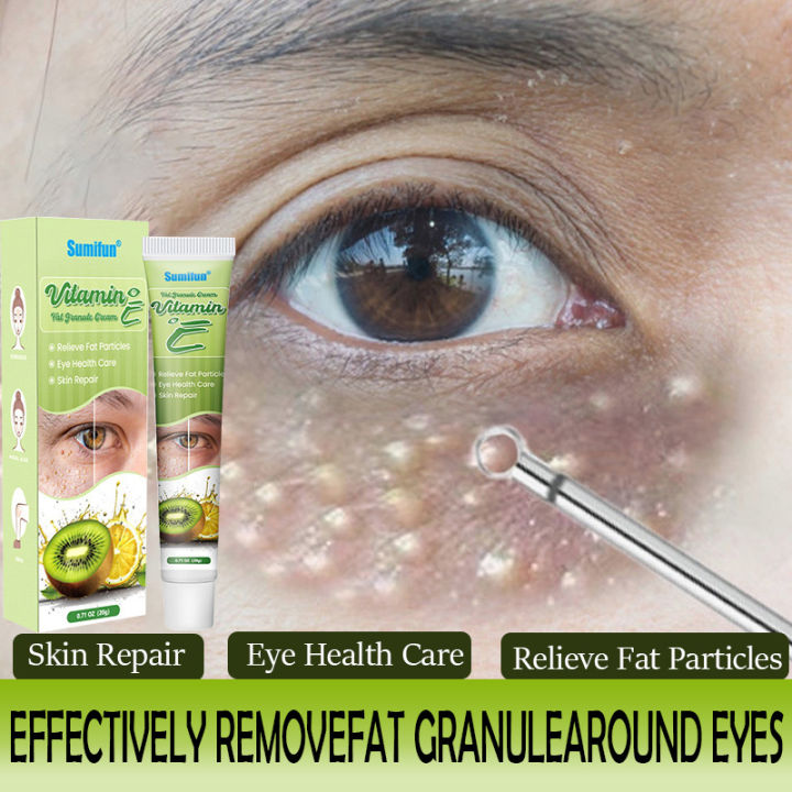 Vitamin E Fat Granules Cream Acid Skin Care Fruit Moisturizing 20g ...