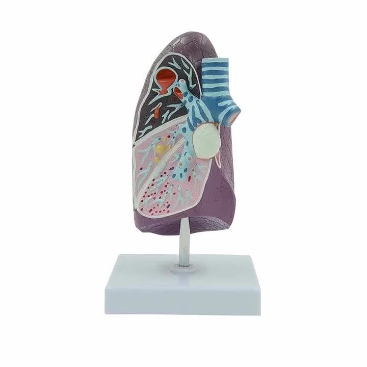 Human Pathological Lung Model Simulation er Lung Internal Organ ...