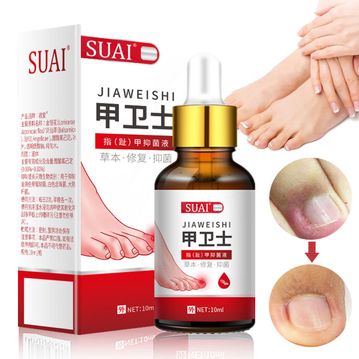 Hailicare Nail Toenail Antibacterial Liquid Ingrown Nail Essential Oil ...
