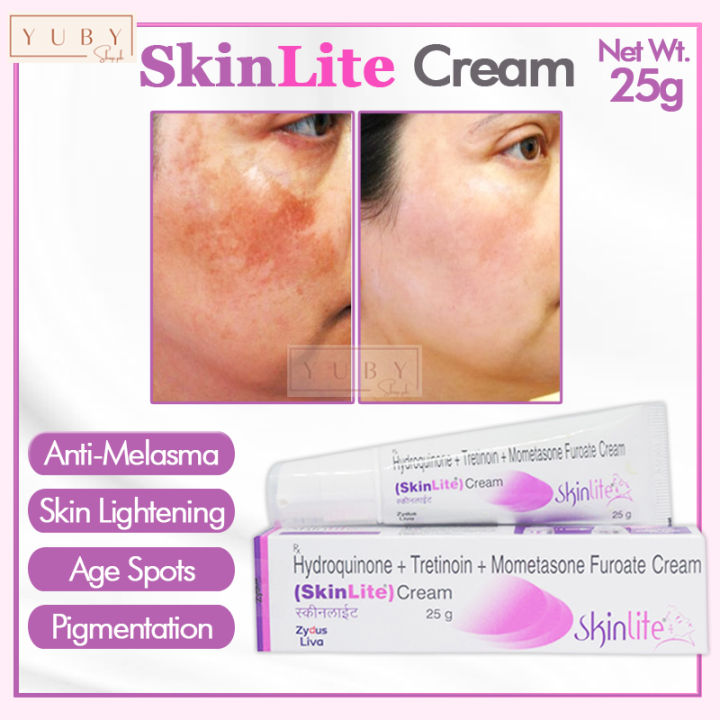 SKINLITE Cream 25g Anti Melasma Pekas Cream Made in India | Lazada PH