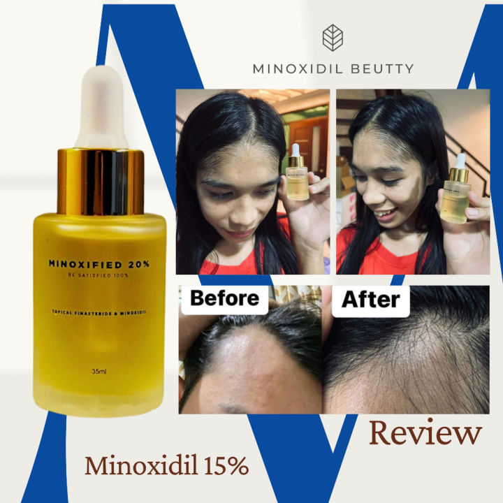 MINOXIFIED 20 hair growth 20 effective oily for your baby hair, para ...