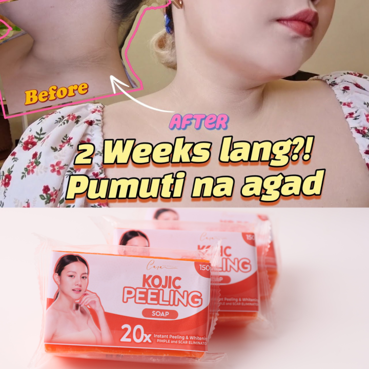 MABISANG SABON NA PAMPAKINIS AT PAMPAPUTI, SOLUSYON DIN SA MGA PEKLAT! WHITENING KOJIC SOAP ...