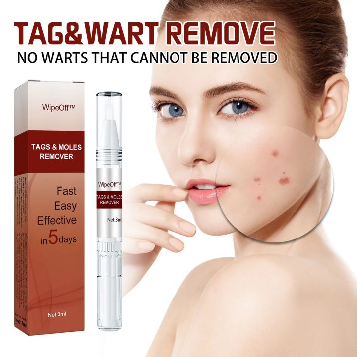 Kero Verruca Repair Smooth Skin Deep clean fade moles flesh moles corns ...