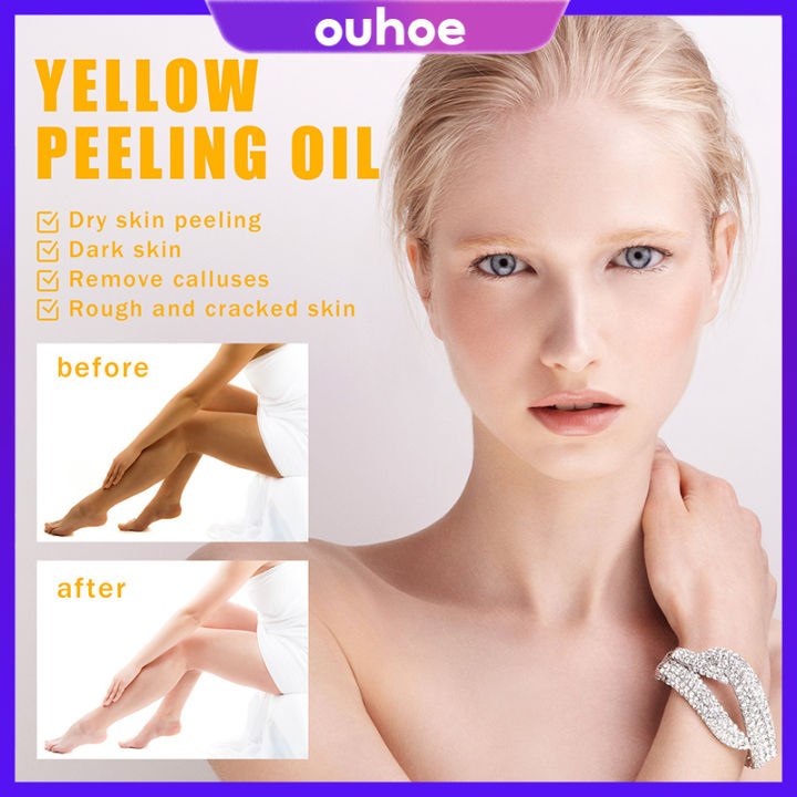 Ouhoe Yellow Peeling Oil Brightening And Moisturizing Skin Removes Dead ...