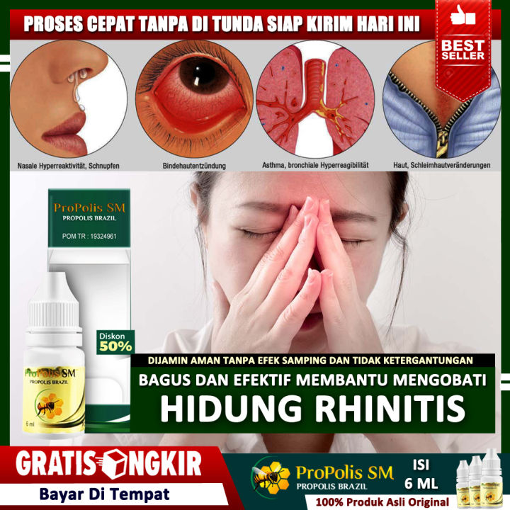 Obat Rhinitis, Rhinitis Alergi, Rhinitis Alergi Dingin, Herbal Rhinitis ...