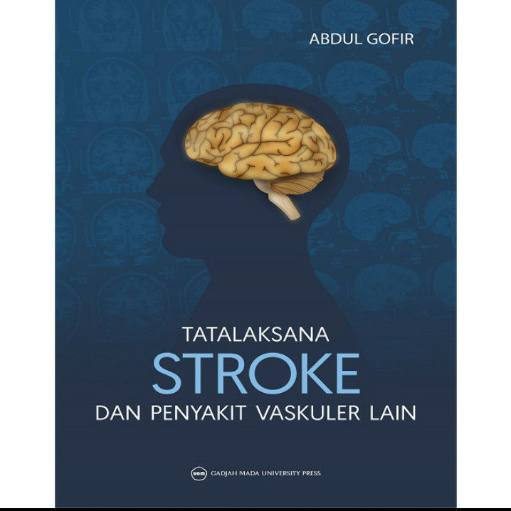 Buku Tatalaksana Stroke dan Penyakit Vaskuler Lainnya | Lazada Indonesia