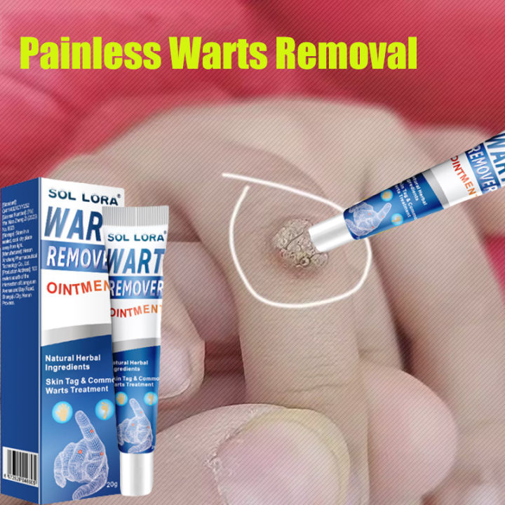 Painless Wart Remover Original Magic Ointment Wart Treatment Cream Skin ...