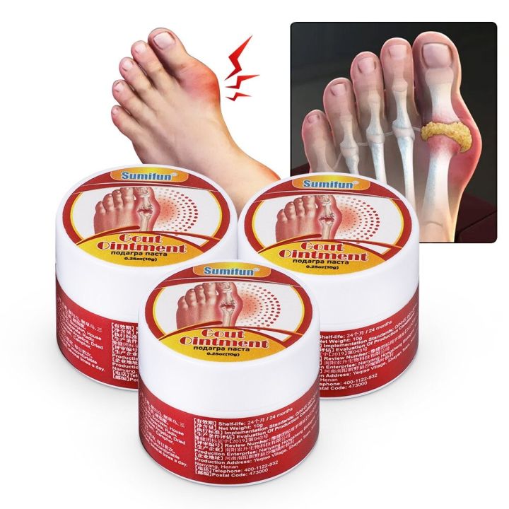 【Ready Stock】10g Gout Treatment Ointment Arthritis Finger Bunion Toe ...