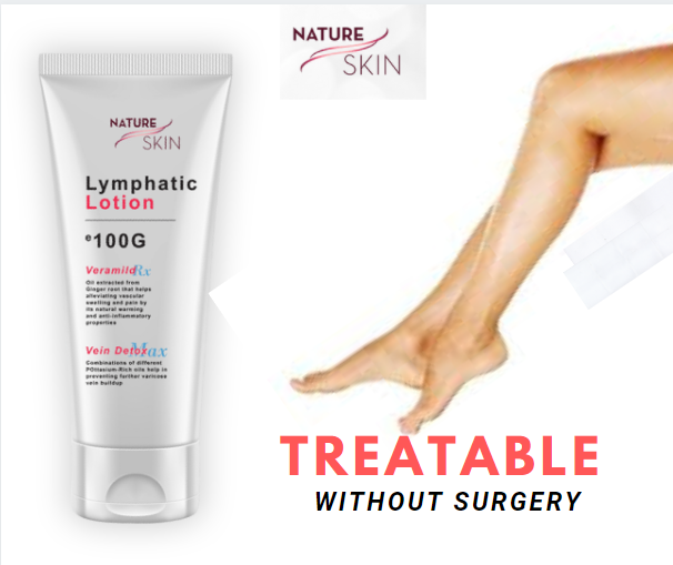 Best Seller Original Nature Skin Lymphatic Lotion Varicose, Spider ...
