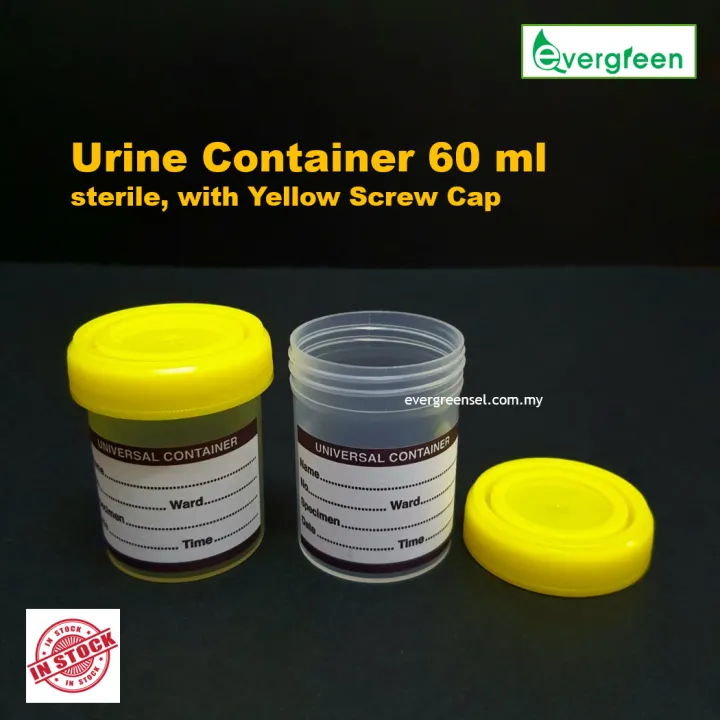Specimen Container (Urine Container / Universal Container ) 60 ml with ...