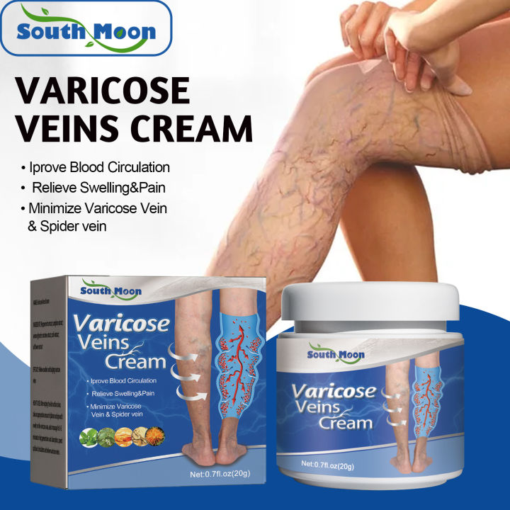 South Moon Varicose Veins Treatment Cream Relieve Legs Tired Dilated ...