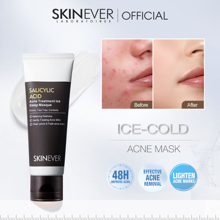 SKINEVER Salicylic Acid Acne Treatment Ice Sleep Masque Anti Acne Anti ...