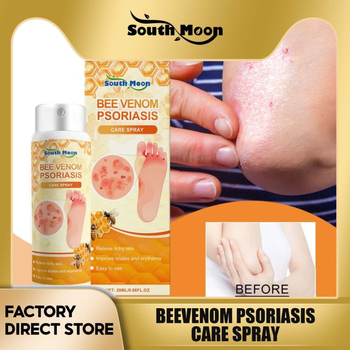 South Moon Bee Venom Psoriasis Care Spray Relieve Rash Desquamation ...