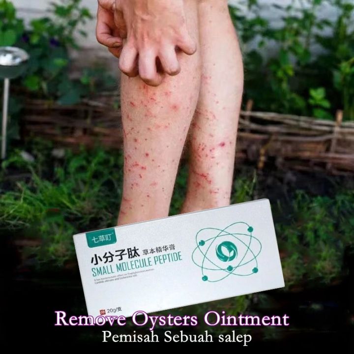 Cowhide moss anti-itching ointment special anti-ringworm ointment for ...