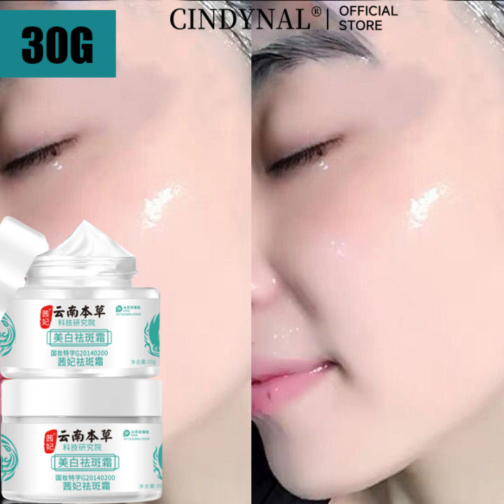 CINDYNAL Yunnan Herbal Whitening Freckle Cream 30g Japanese Melasma ...