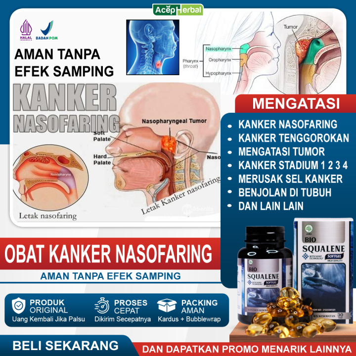 Obat kanker Nasofaring Tumor Ganas Di Tenggorokan Hidung Berdarah ...