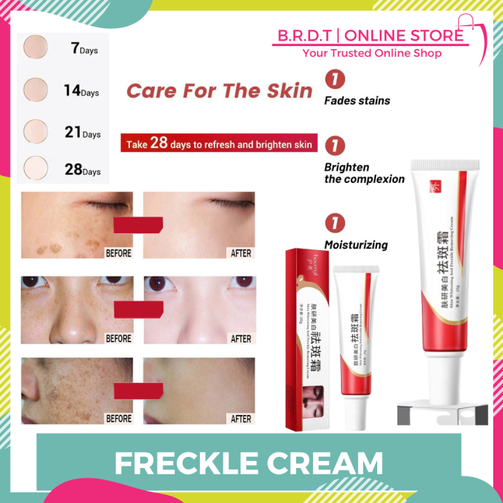 Houmai Freckle Cream Whitening Cream Melanin and Skin Moisturizing 20g ...