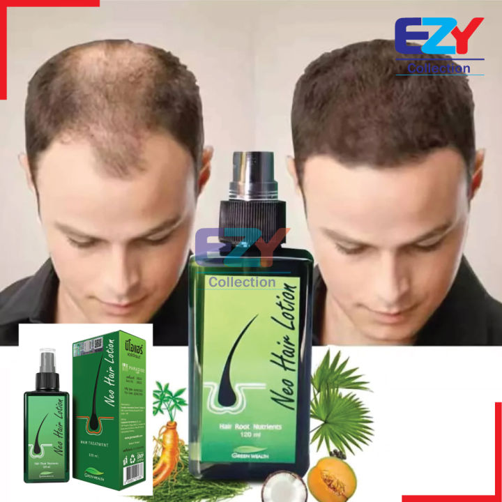 Neo Hair Green Wealth Neo Hair Lotion Growth Root Hair Loss Nutrients ...