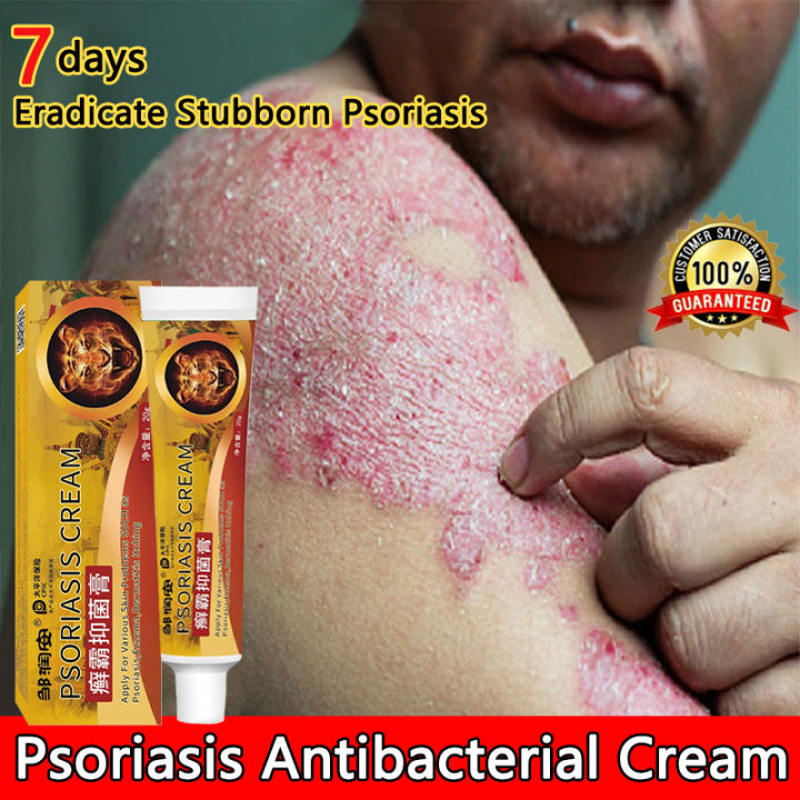 🔥Fast results in 7 days🔥Psoriasis Eczema Treatment Cream Ointment for ...