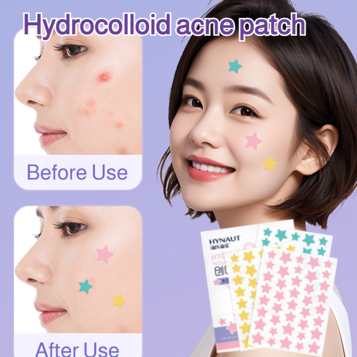 Acne patch Bandage Hydrocolloid acne patch Five-pointed star shape Can ...