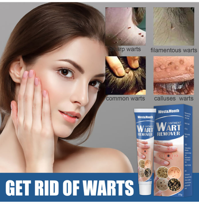 biaozhen Effective Cream for Filiform Warts on Hands and Feet | Lazada ...