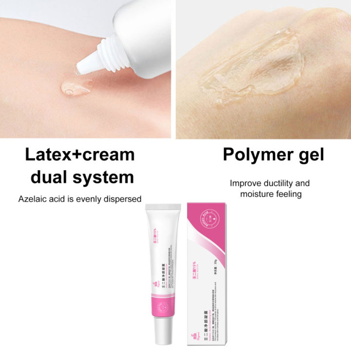 Ac-ne Treatment Cream Face Gel Skin Scar 30g Azelaic Acid Removal Cream ...