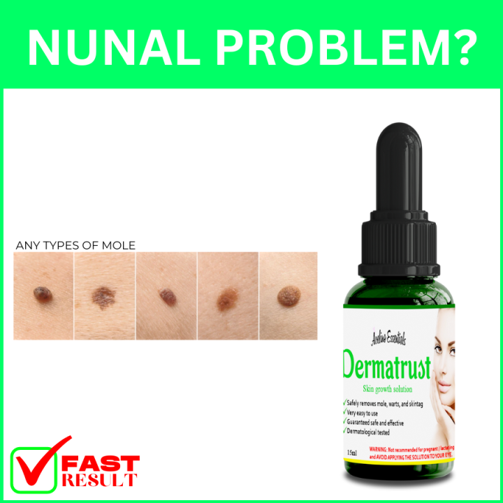DERMATRUST NUNAL REMOVAL Skin Growth Remover , nunal removal cream ...