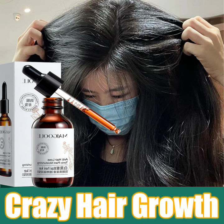 【fast Effective 】hair Growth Serum Ginger Hair Tonic 30ml Hair Growth