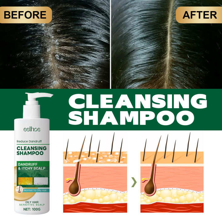 Eelhoe Cleansing Shampoo Dandruff Repair Anti-Dandruff Root Intensive ...