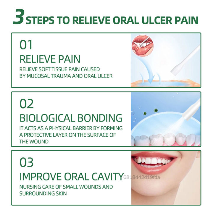 Canker Sore Treatment Spray Oral Care Pain Relief Mist for Fresh Breath ...