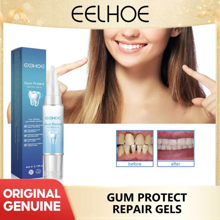 【Hot Sale】Eelhoe Gum Repair Gel Rebuilding Strengthen Whiten Remove ...