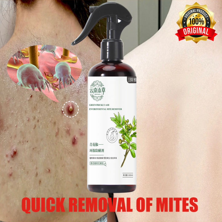 300ML Mite Spray Bed Bug Killer Dust Mite Remove Spray Non-toxic ...