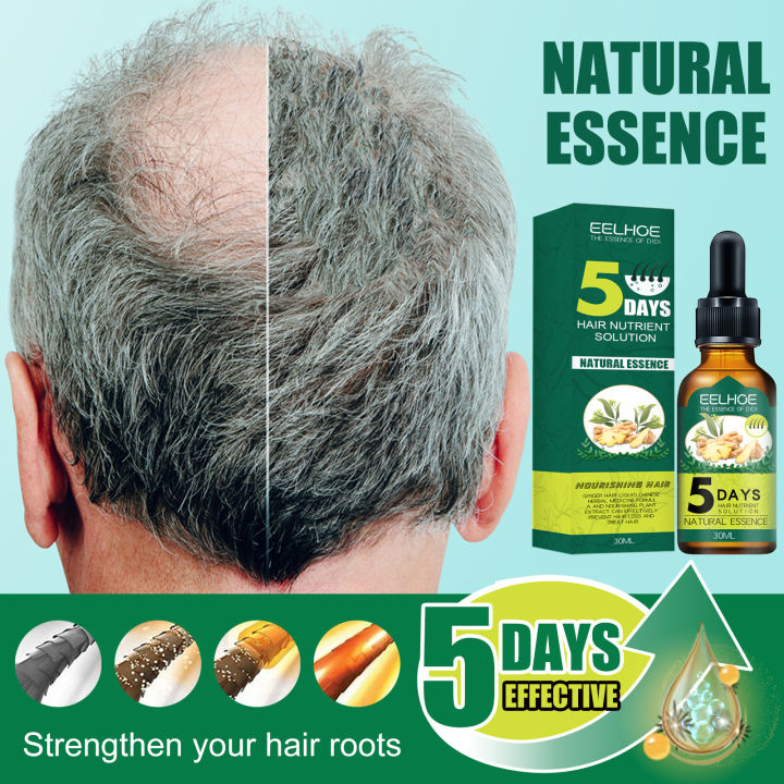Eelhoe 5Days Hair Nutrient Solution Hair Growth Essence Germinal Serum ...