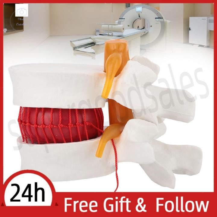 1:1.5 Medical Demonstration Model Of Lumbar Vertebral Spine Human ...